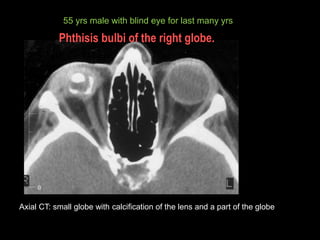 CT and MRI | PPTX