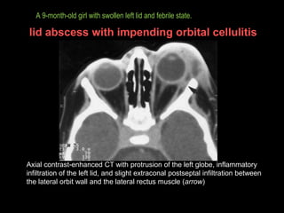 CT and MRI | PPTX