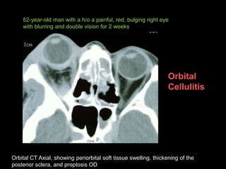 CT and MRI | PPTX