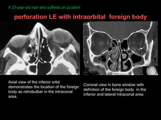 CT and MRI | PPTX