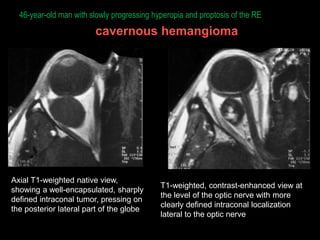 CT and MRI | PPTX