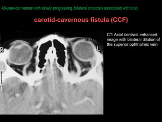 CT and MRI | PPTX