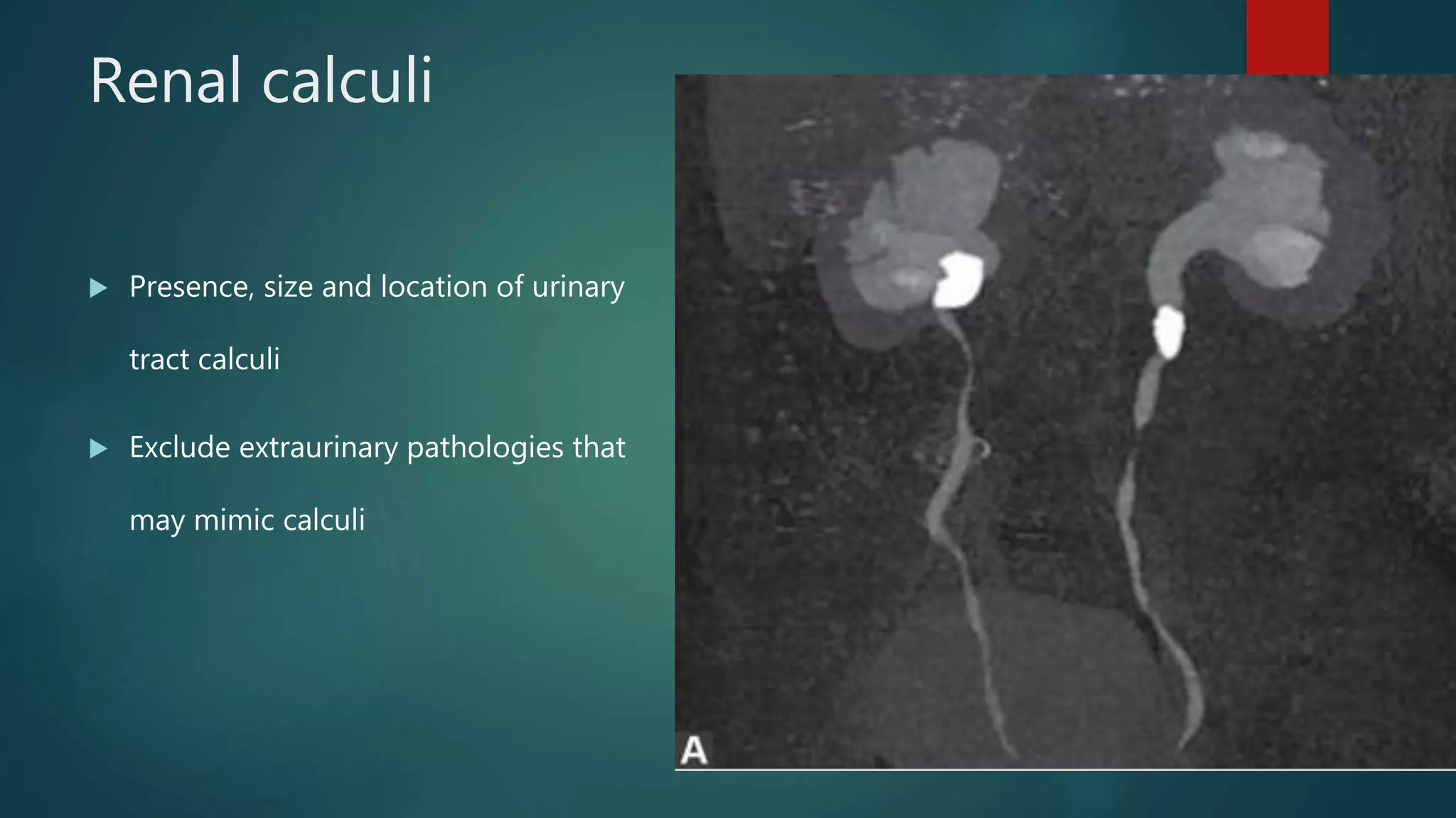 Ct mri urography | PPTX