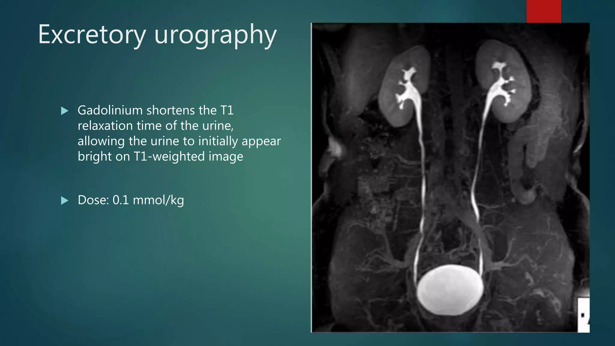 Ct mri urography | PPTX