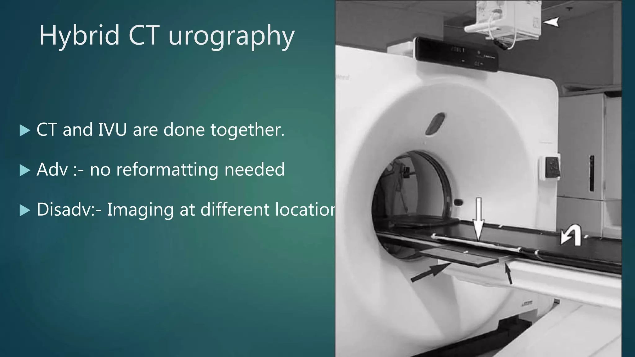 Ct mri urography | PPTX