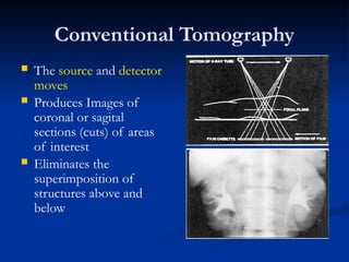 Computed Tomography BOOk: physical processes of medical imaging | PPTX