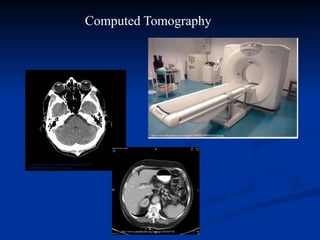 Computed Tomography BOOk: physical processes of medical imaging | PPT