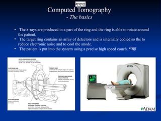 Computed Tomography BOOk: physical processes of medical imaging | PPT