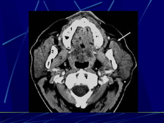 CT ANATOMY OF THE NECK SPACES | PPT