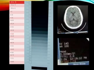CT numbers, window width and window level | PPTX