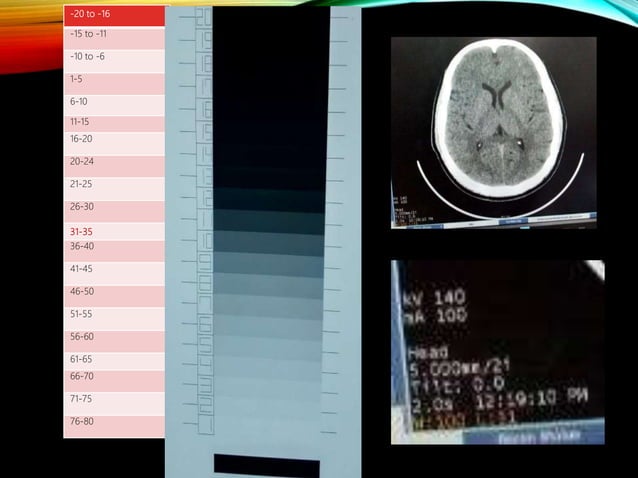 CT numbers, window width and window level | PPTX | Lung and Respiratory ...