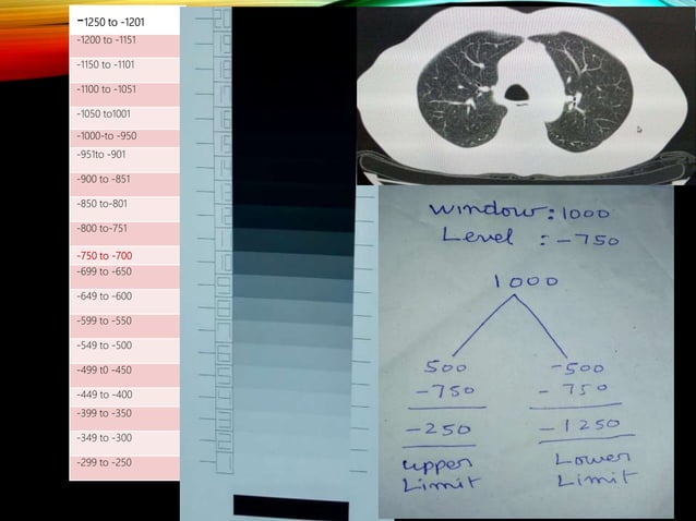 CT numbers, window width and window level | PPTX | Lung and Respiratory ...