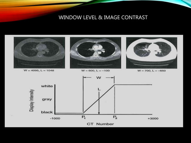 CT numbers, window width and window level | PPTX | Lung and Respiratory ...