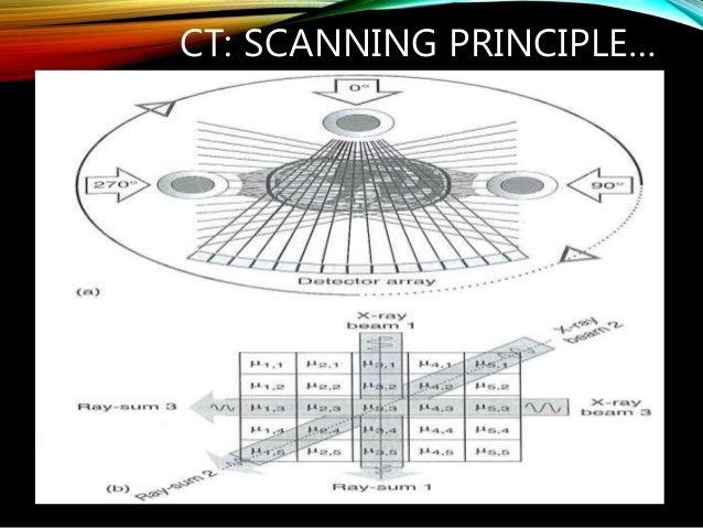 CT numbers, window width and window level