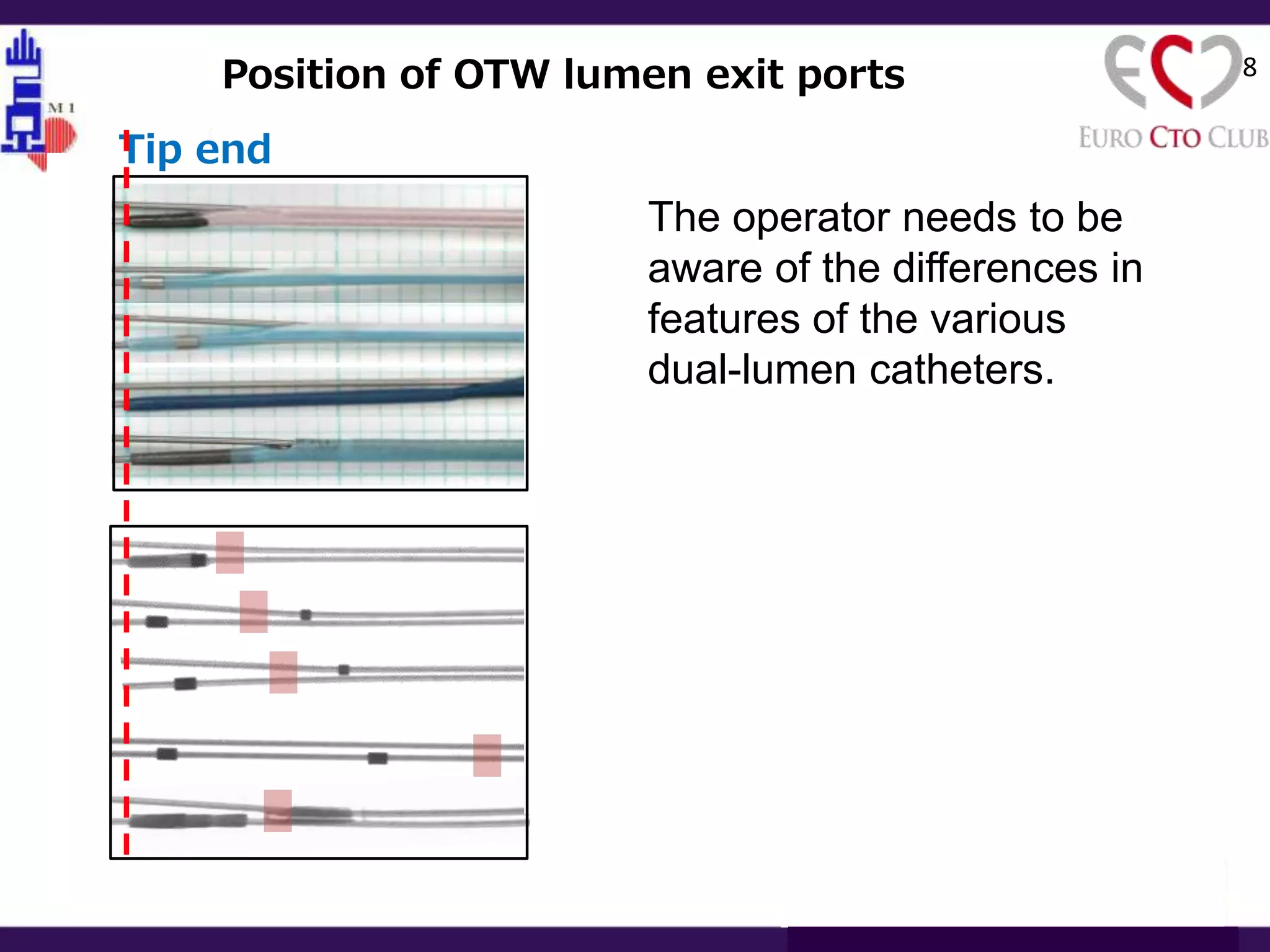 CTO and bifurcation: Tips and tricks | PPTX