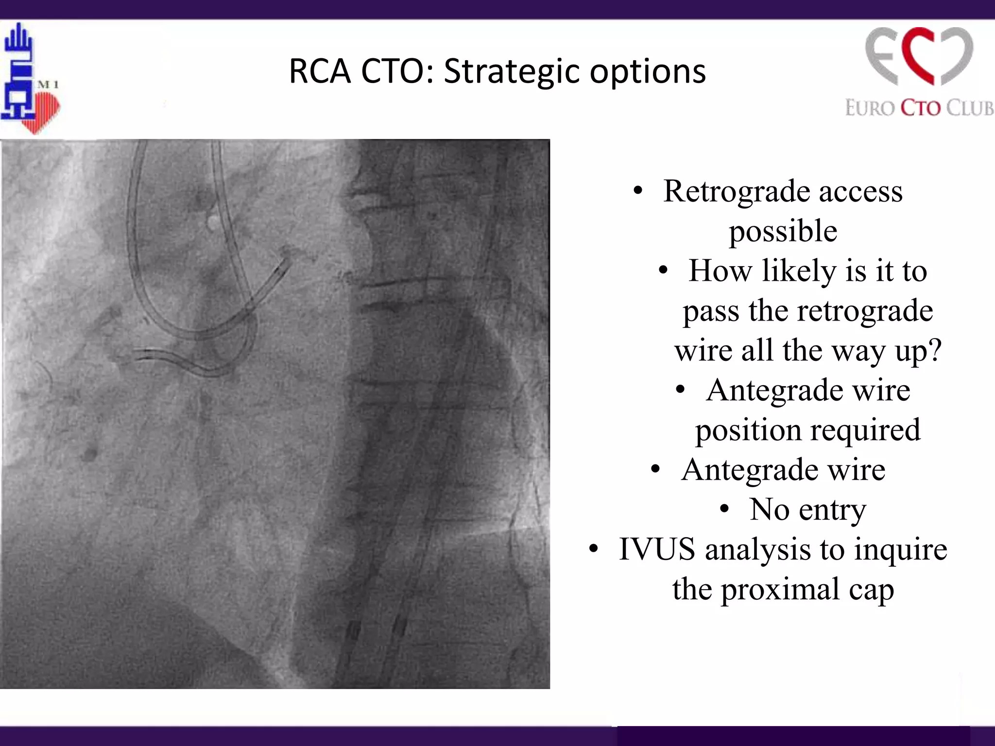 CTO and bifurcation: Tips and tricks | PPTX