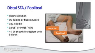 Treatment of Long Lesions and Femoropopliteal CTO | PPSX