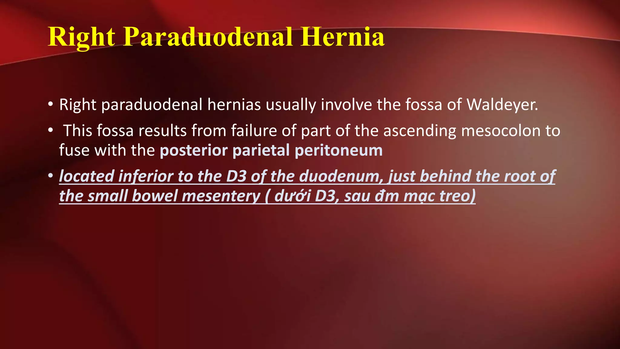 CT of Internal Hernia | PPTX