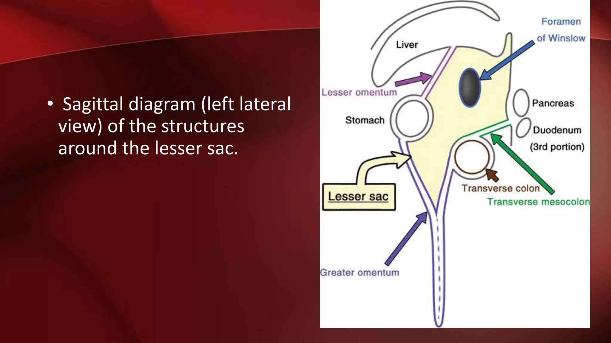 CT of Internal Hernia | PPTX