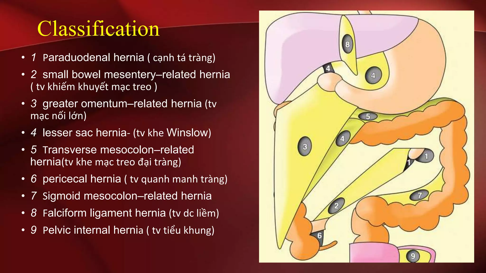 CT of Internal Hernia | PPTX