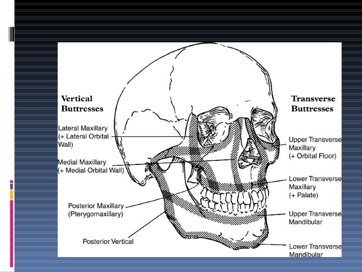 Ct of maxillofacial trauma