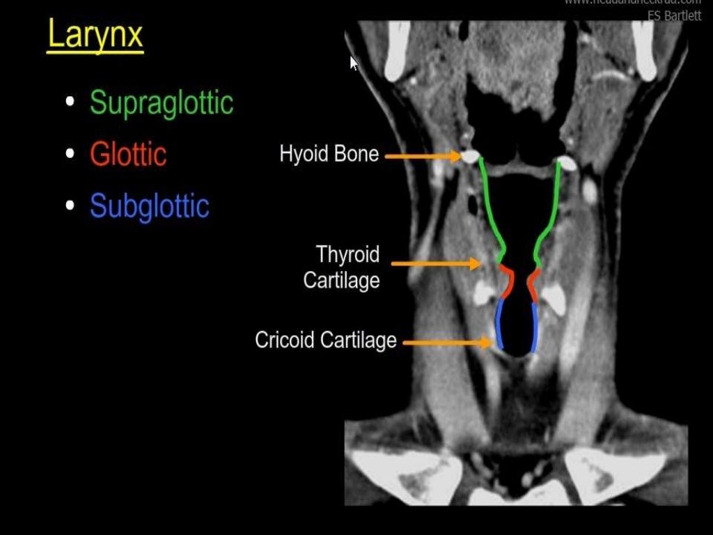 Ct of the larynx