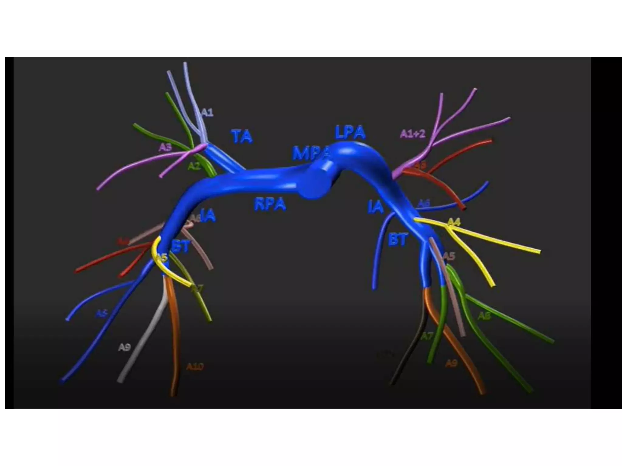 CT Pulmonary Angiography | PPTX
