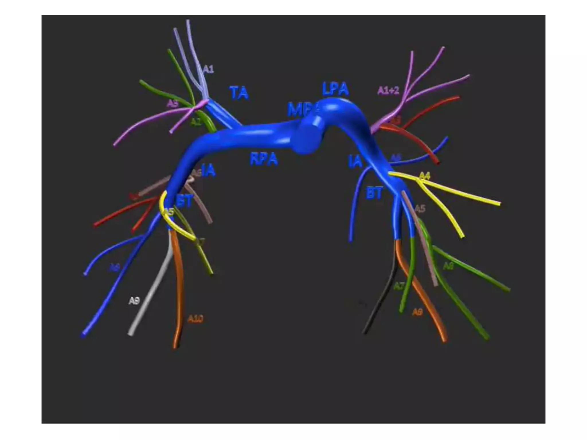 CT Pulmonary Angiography | PPTX