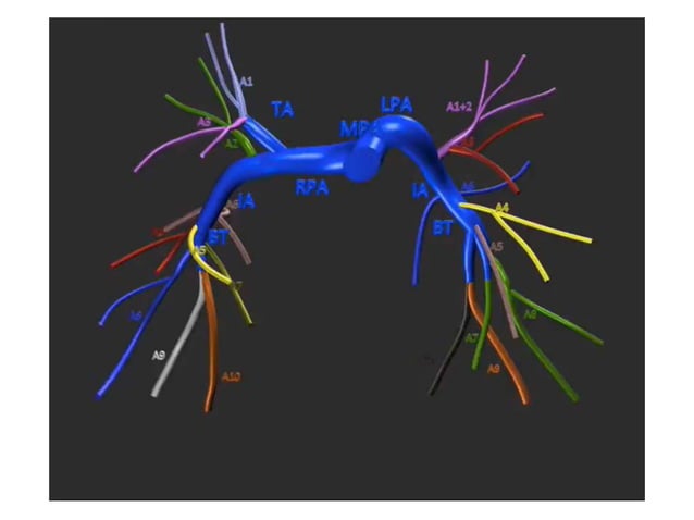 Ct Pulmonary Angiography Pptx