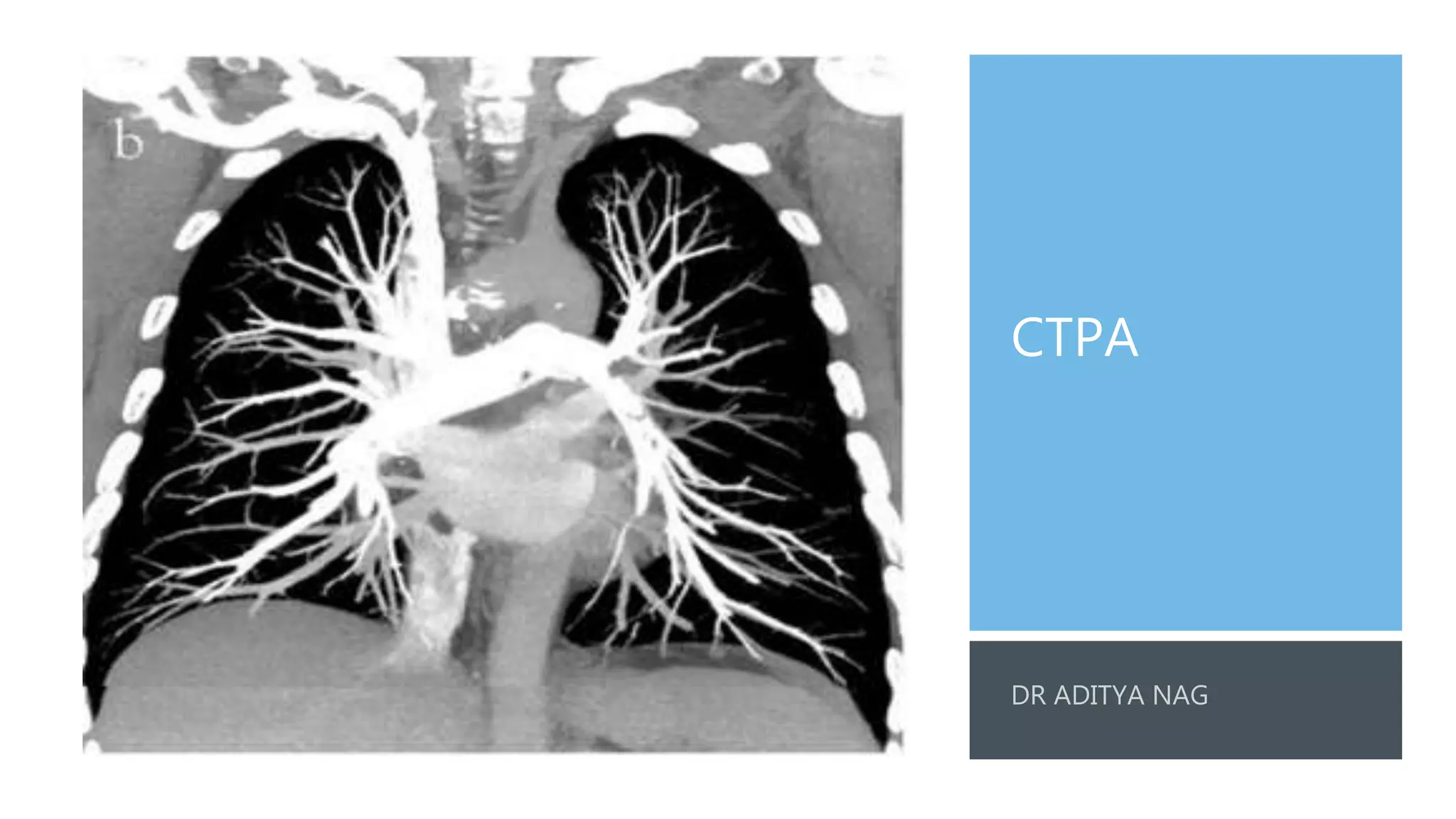 CT PA | PPTX