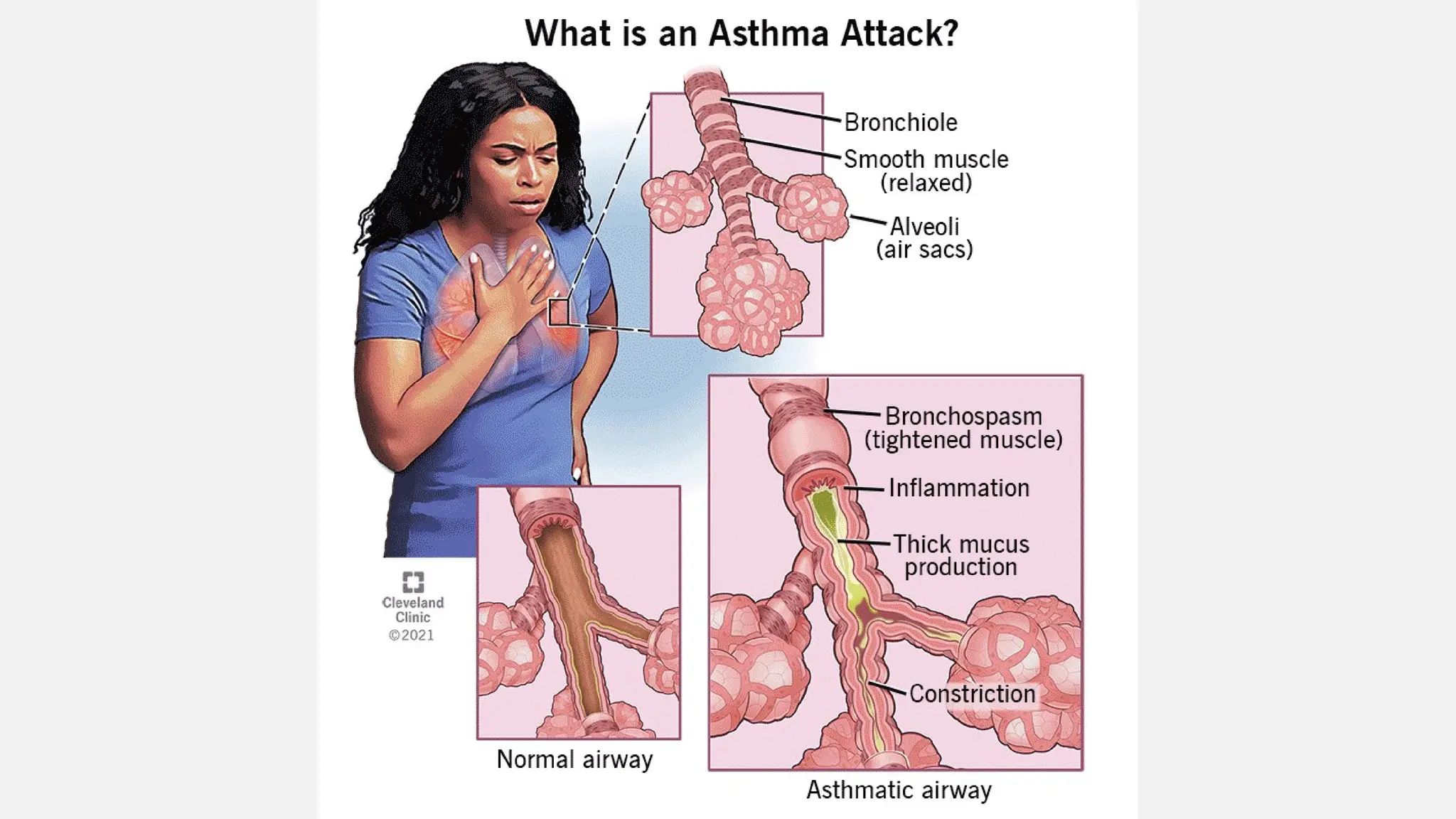 CTP and Barcelona Clinic Liver Cancer Staging scoring systems.pptx
