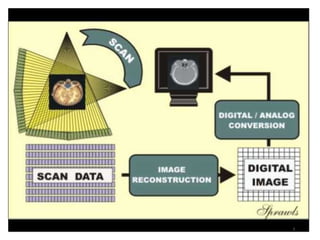 Computed Tomography Basic Principles and protocol | PPT