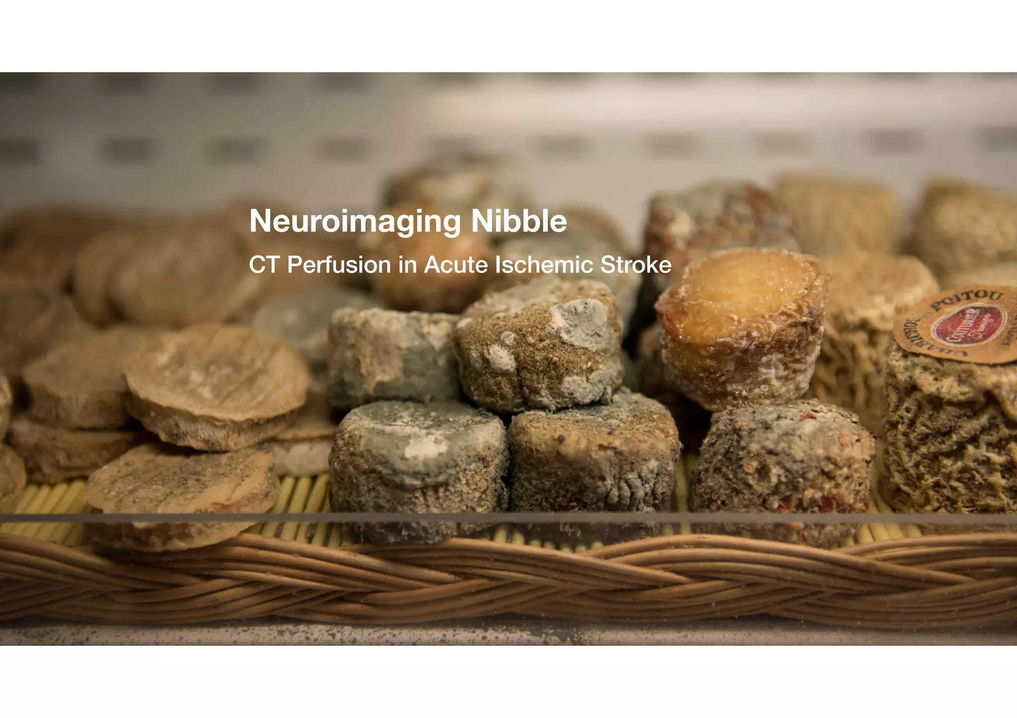 Neuro EM: Neuroimaging Nibble CTP mismatch in Acute Ischemic Stroke | PPT