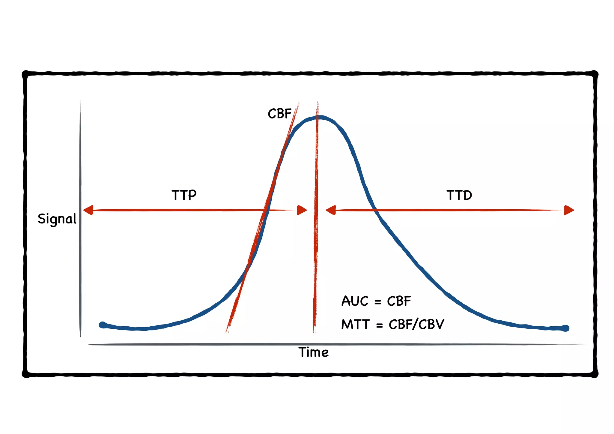 Neuro EM: Neuroimaging Nibble CTP mismatch in Acute Ischemic Stroke | PPT