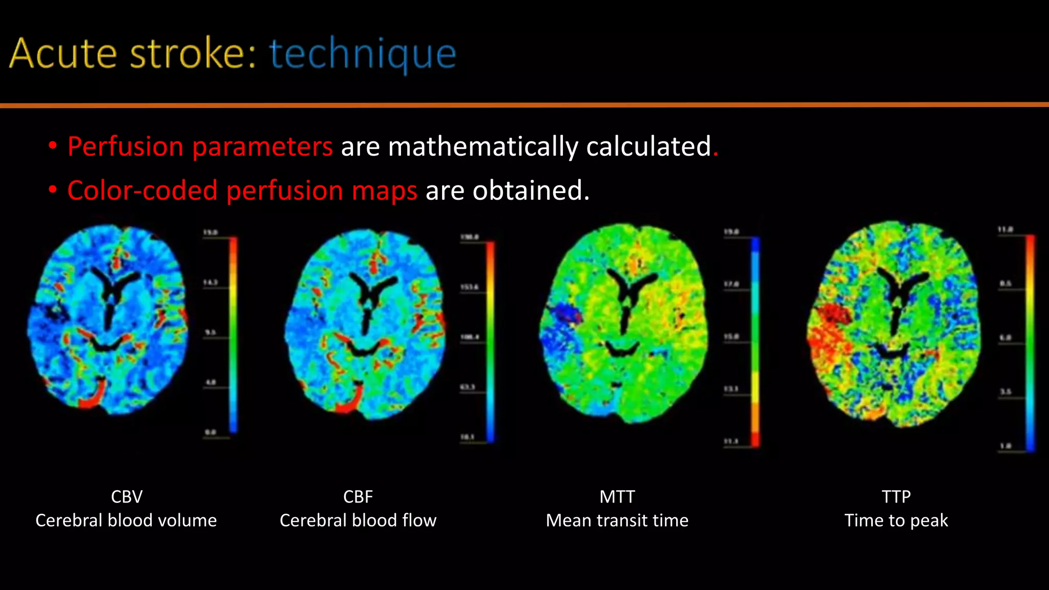 Ct perfusion | PPSX
