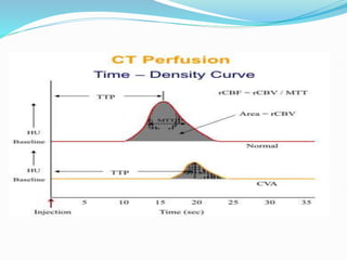 CT_Perfusion.pptx