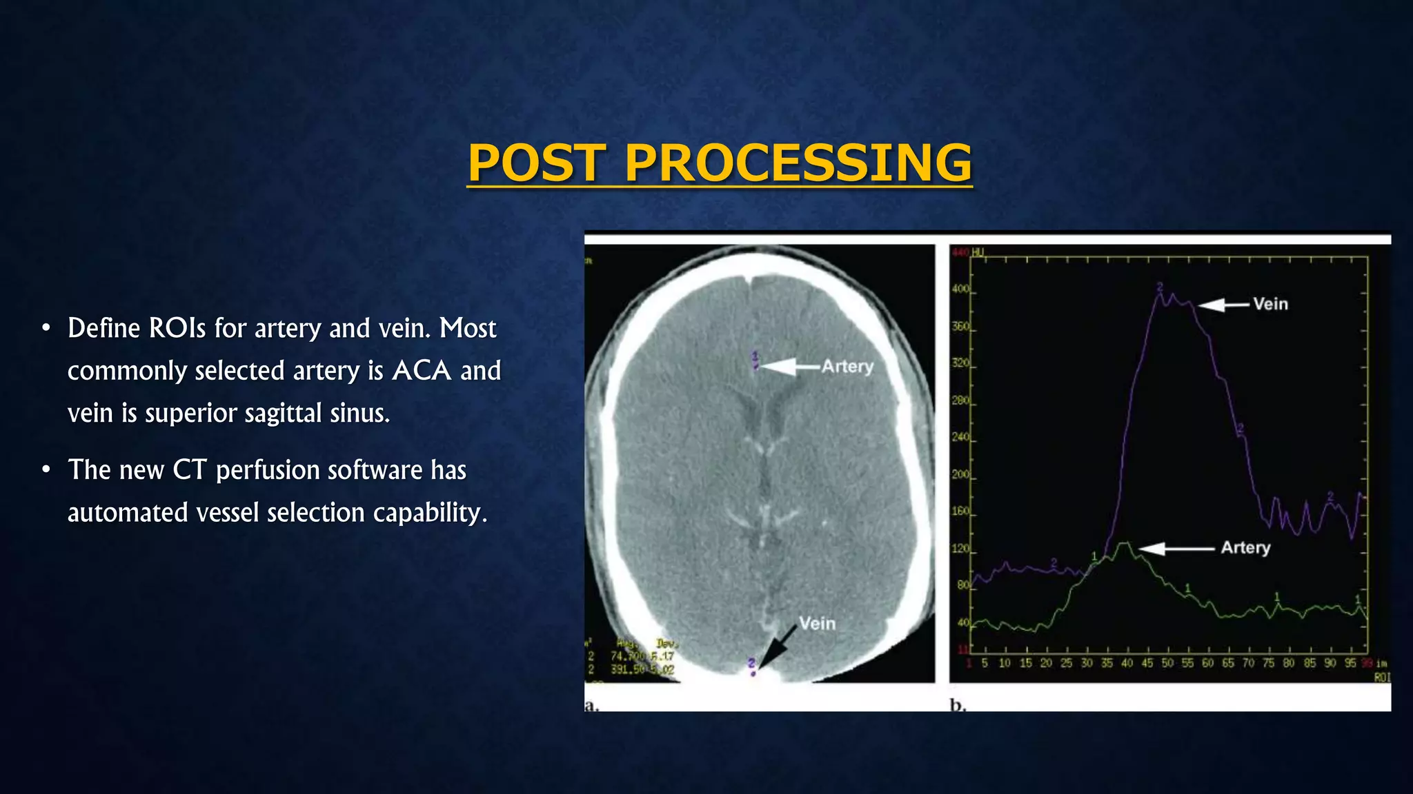 CT perfusion physics and its application in Neuroimaging | PPTX