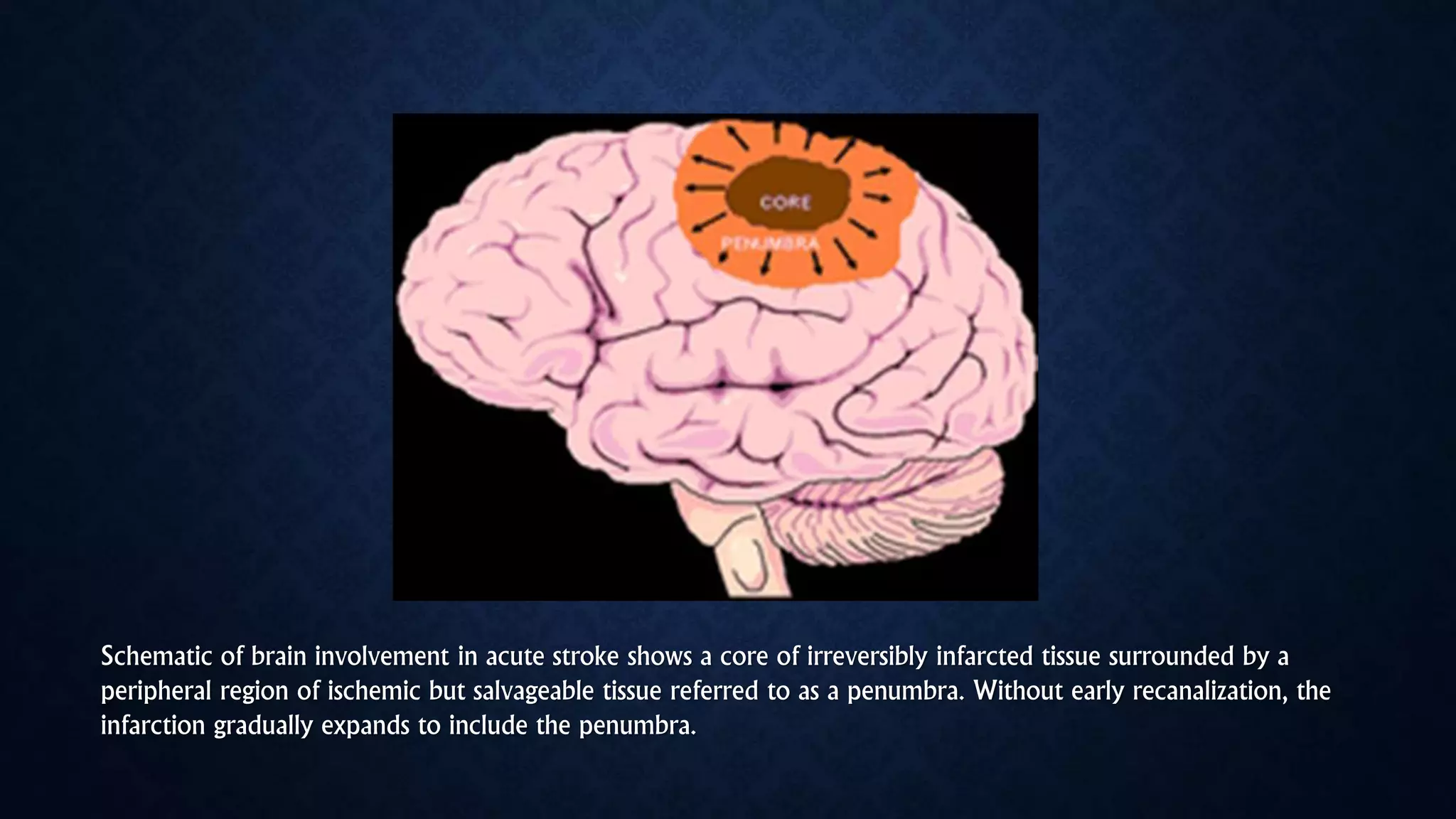 CT perfusion physics and its application in Neuroimaging | PPTX