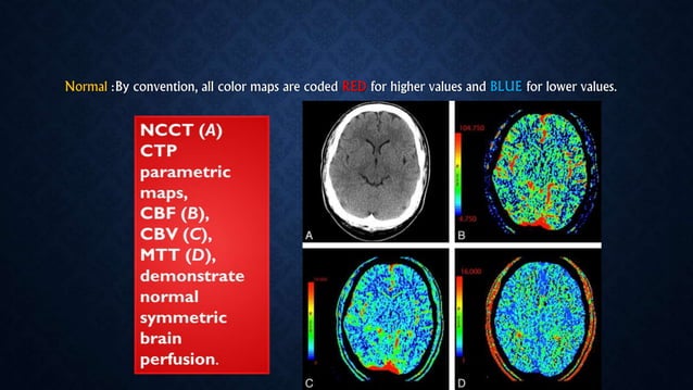 CT perfusion physics and its application in Neuroimaging | PPTX ...