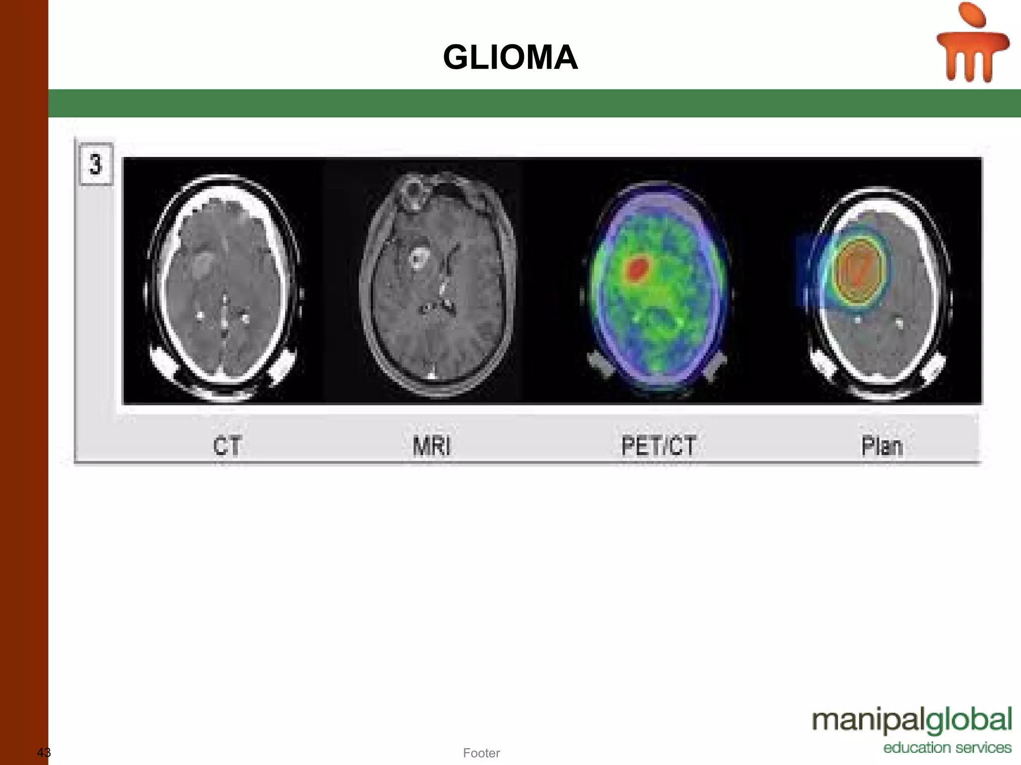 BASICS IN NEUROIMAGING: CT, MRI AND PET | PPT