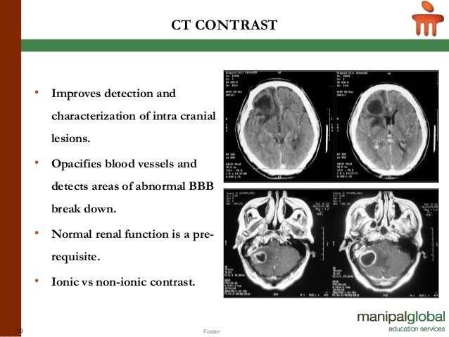 Difference Between An Mri Ct And Xray Scan Omega Pds
