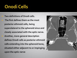 CT ANATOMY OF PARA NASAL SINUSES | PPTX