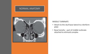 Imaging of paranasal sinuses RV | PPTX