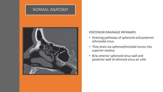 Imaging of paranasal sinuses RV | PPTX