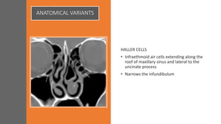 Imaging of paranasal sinuses RV | PPTX
