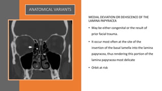Imaging of paranasal sinuses RV | PPTX