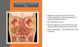 Imaging of paranasal sinuses RV | PPTX
