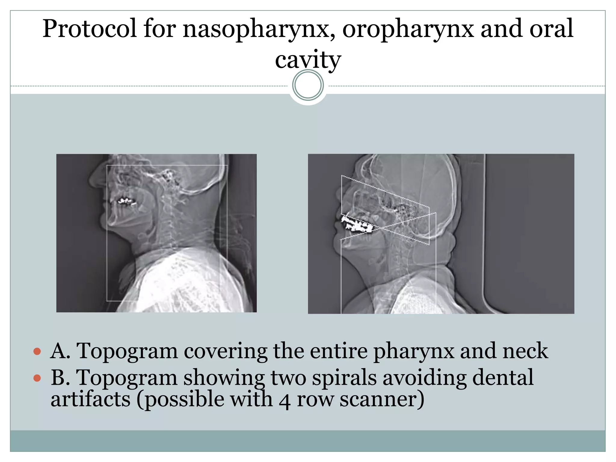 CT procedure of neck | PPTX