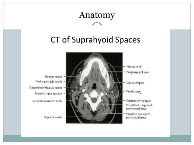 CT procedure of neck | PPTX