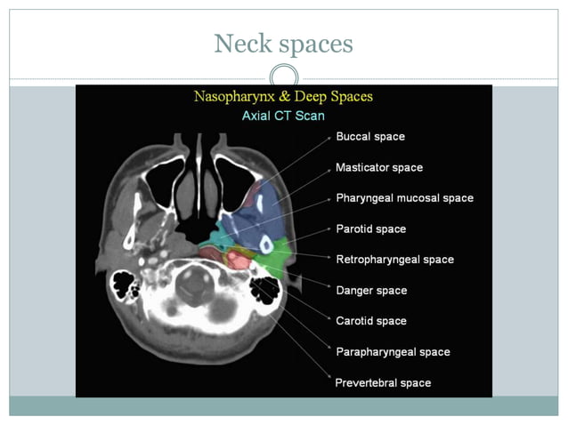 CT procedure of neck | PPTX
